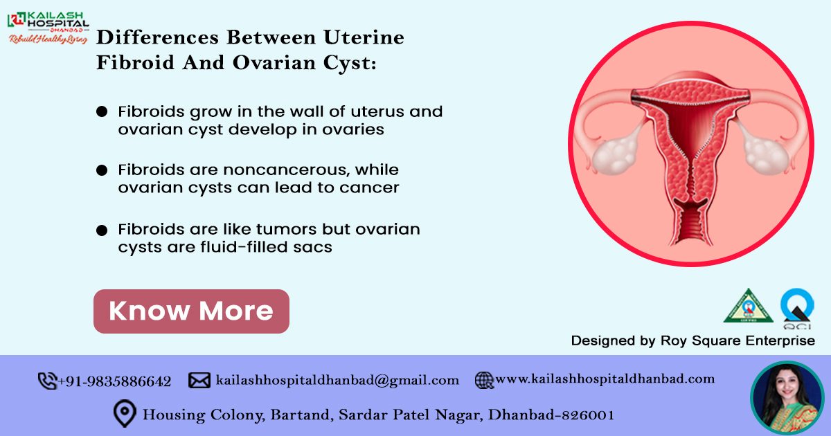 Difference Between Ovarian Cyst and Fibroid: Key factors