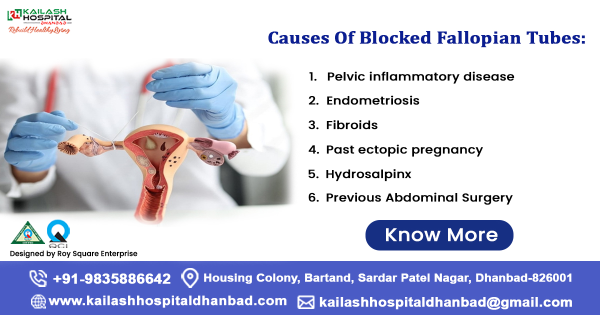 Blocked Fallopian Tubes: Causes, Symptoms & Treatment