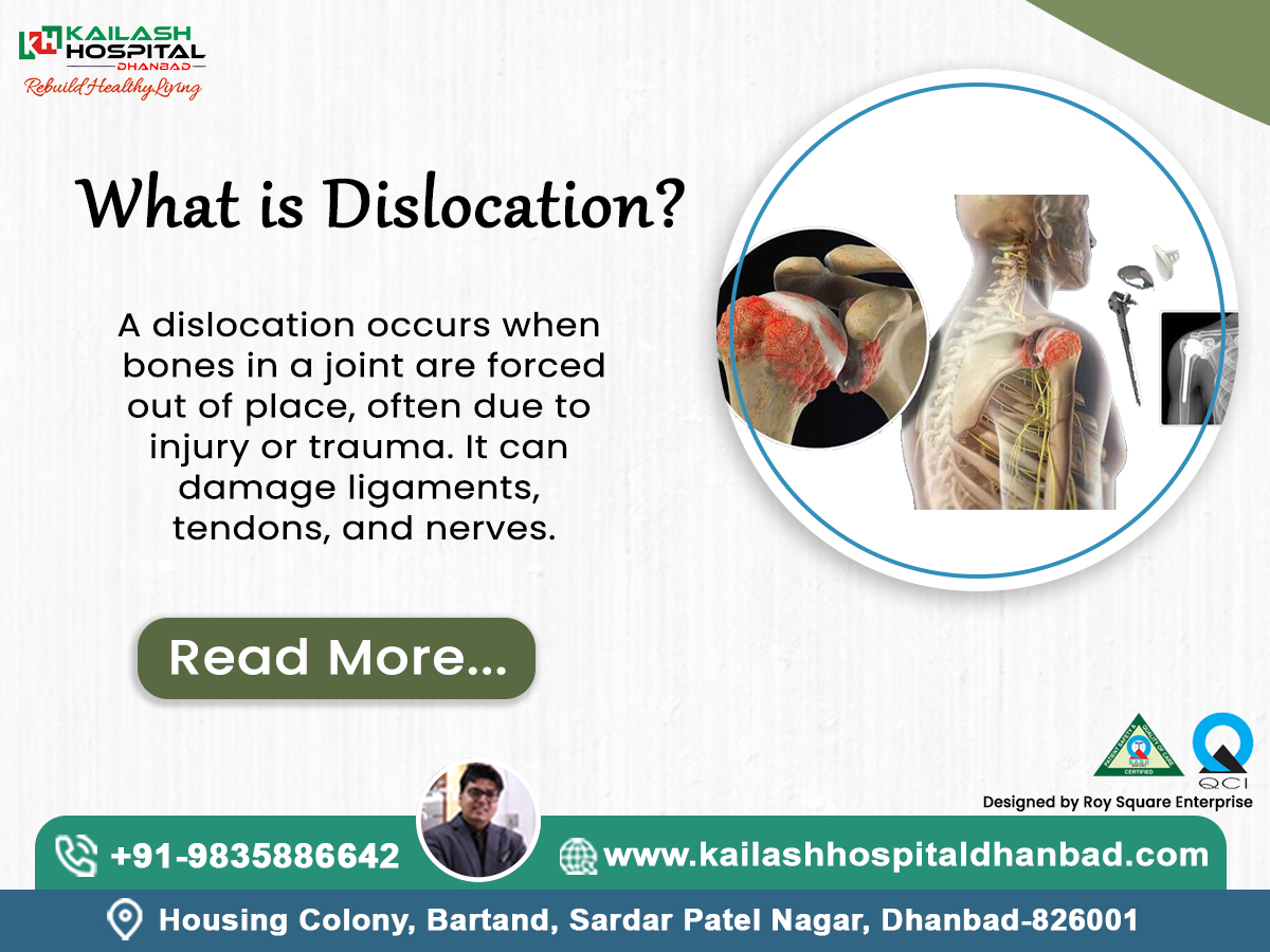 Dislocation: Causes, Types, Symptoms & Treatment