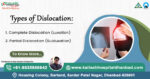 Dislocation: Causes, Types, Symptoms & Treatment
